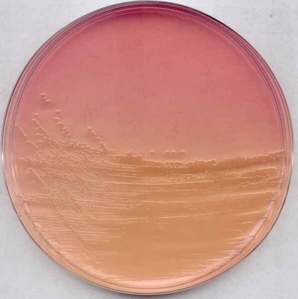 ENDO agar | 104044